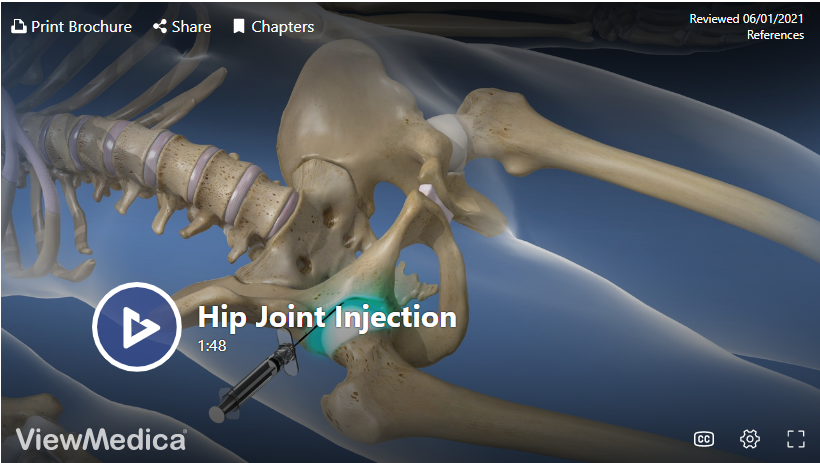 Hip Joint Injection in Knoxville, TN - Omega Pain Management