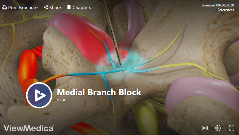 Medial Branch Block in Knoxville - Omega Pain Management Medial Branch Block in Knoxville - Omega Pain Management
